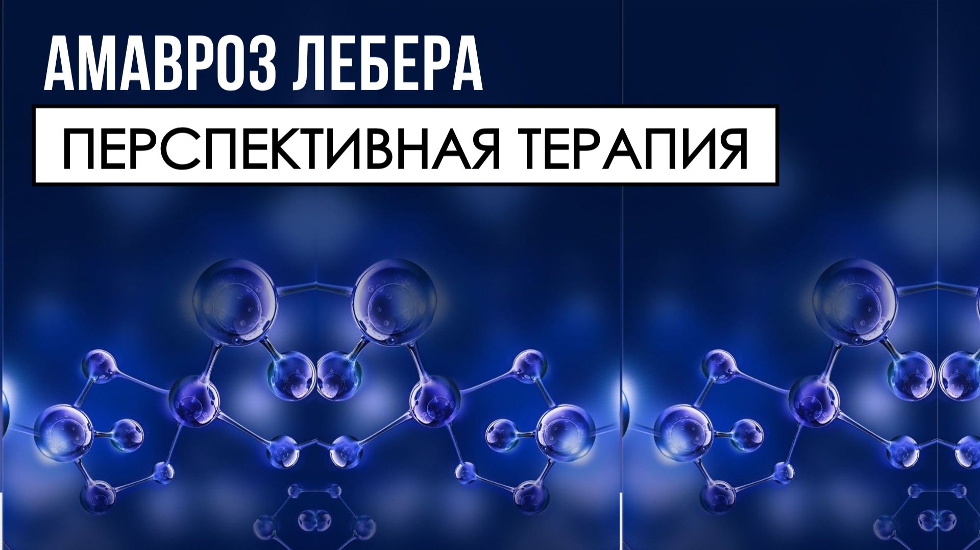 Амавроз Лебера: перспективная терапия