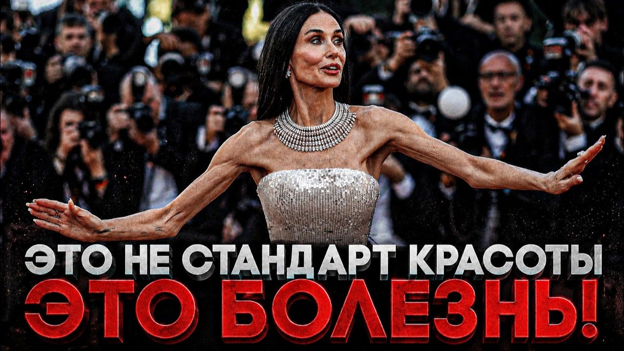 Alex СМОТРИТ: ЭТО НЕ СТАНДАРТ КРАСОТЫ, ЭТО БОЛЕЗНЬ! (СТЕБЛОВ)