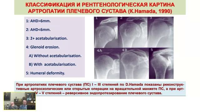Современные возможности артроскопического трансфера сухожилий и послеоперационной реабилитации...