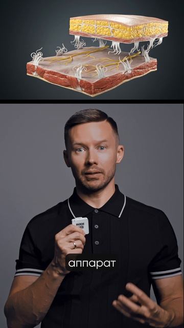 💫 Почему DEEP PLANE FACELIFT?