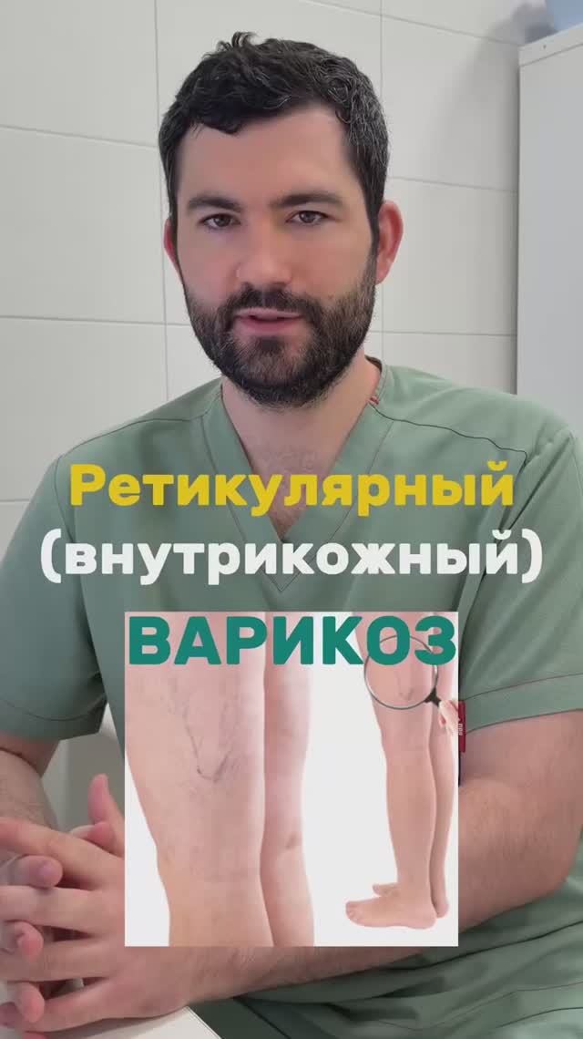 🩺 Ретикулярный варикоз: как его выявляют и кто занимается лечением? ЛД Медицина