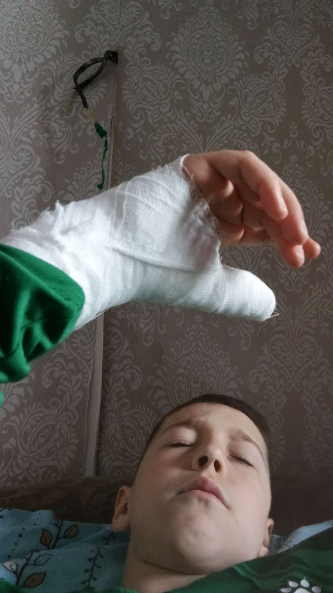 У меня перелом пальца 😔😔😔😔