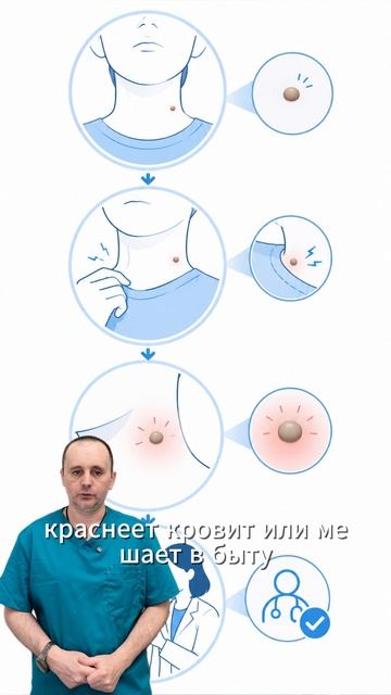 Папиллома на шее мешает — почему нельзя терпеть