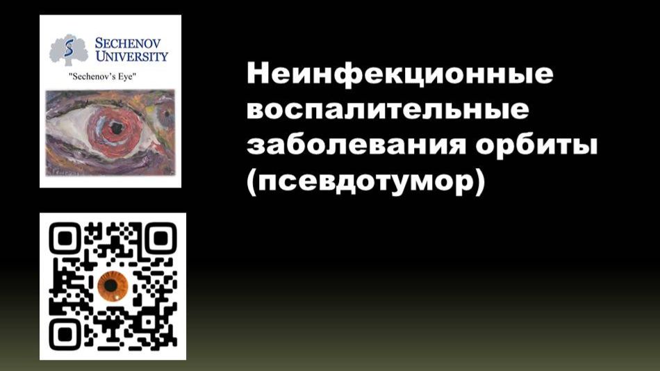 Неинфекционные воспалительные заболевания орбиты (псевдотумор)