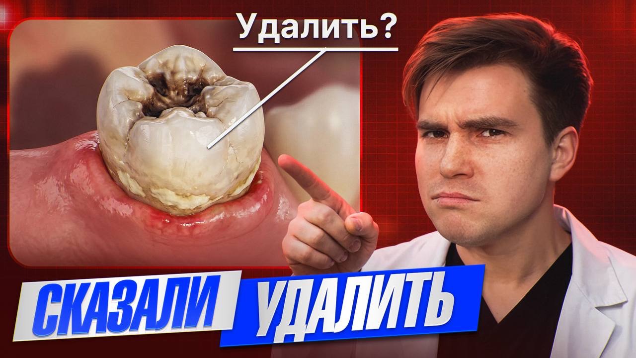 Не удаляй разрушенный зуб! Его можно спасти (1)