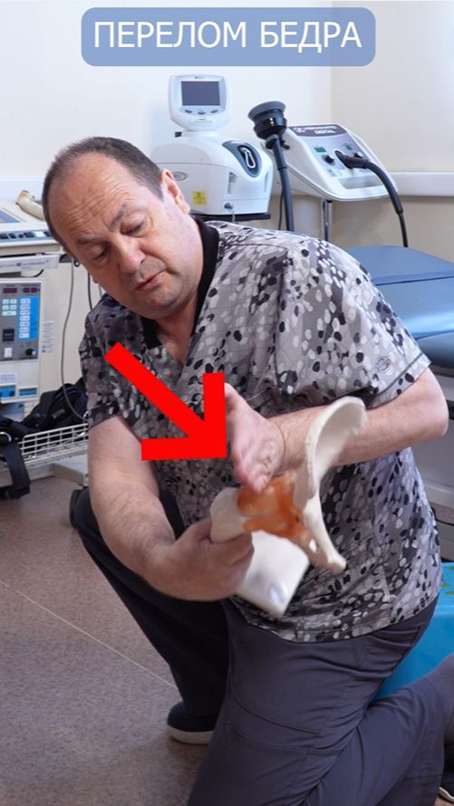 Перелом бедра у пожилых. Как предотвратить?!  #переломбедра #переломшейкибедра #остеопороз