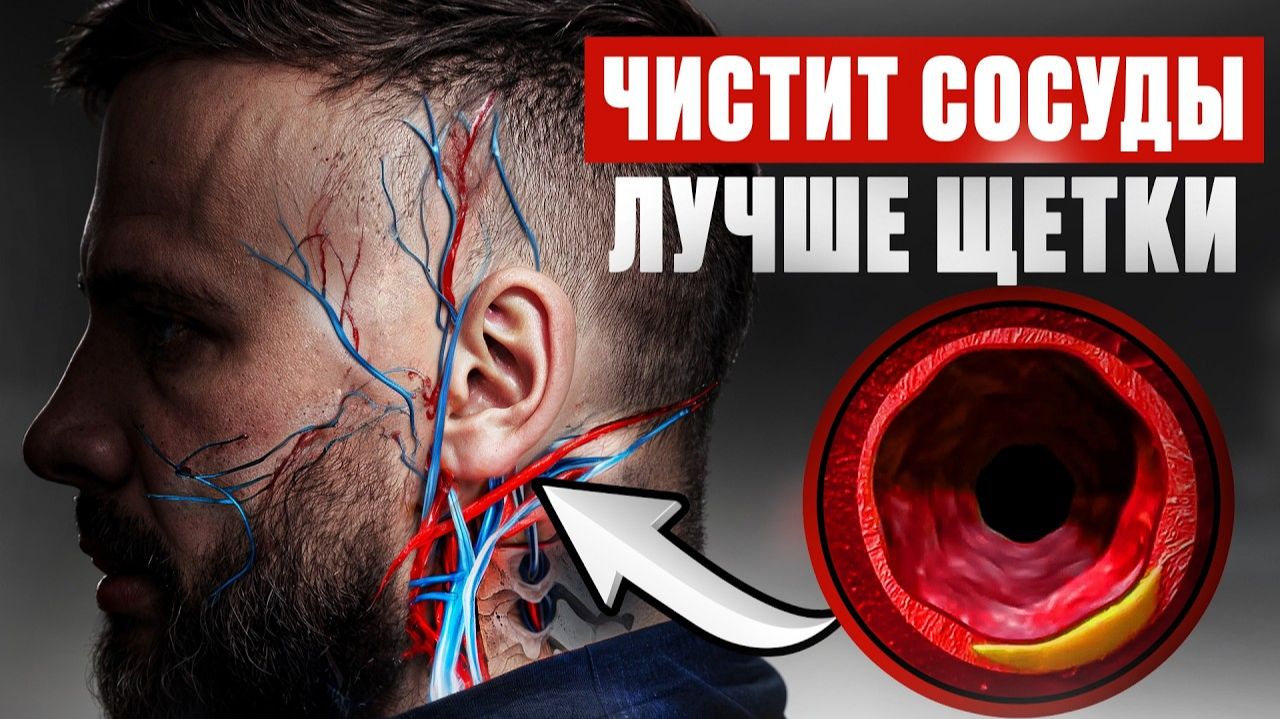 Как очистить сосуды от бляшек и тромбов за 5 простых шагов (Михаил Маханов)