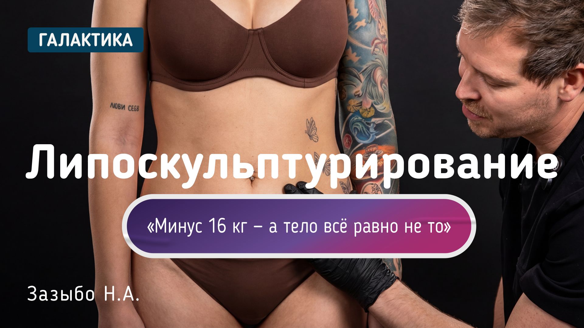 Липоскульптурирование тела после родов | Анна у Николая Зазыбо