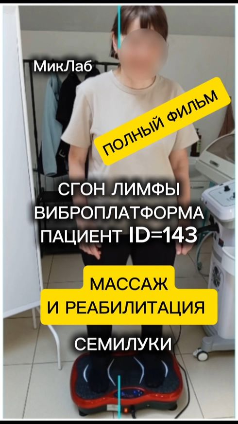 Сгон ЛИМФЫ. ВиброПлатформа. Полный фильм. Пациент ID=143. Массаж и Реабилитация Семилуки. МикЛаб