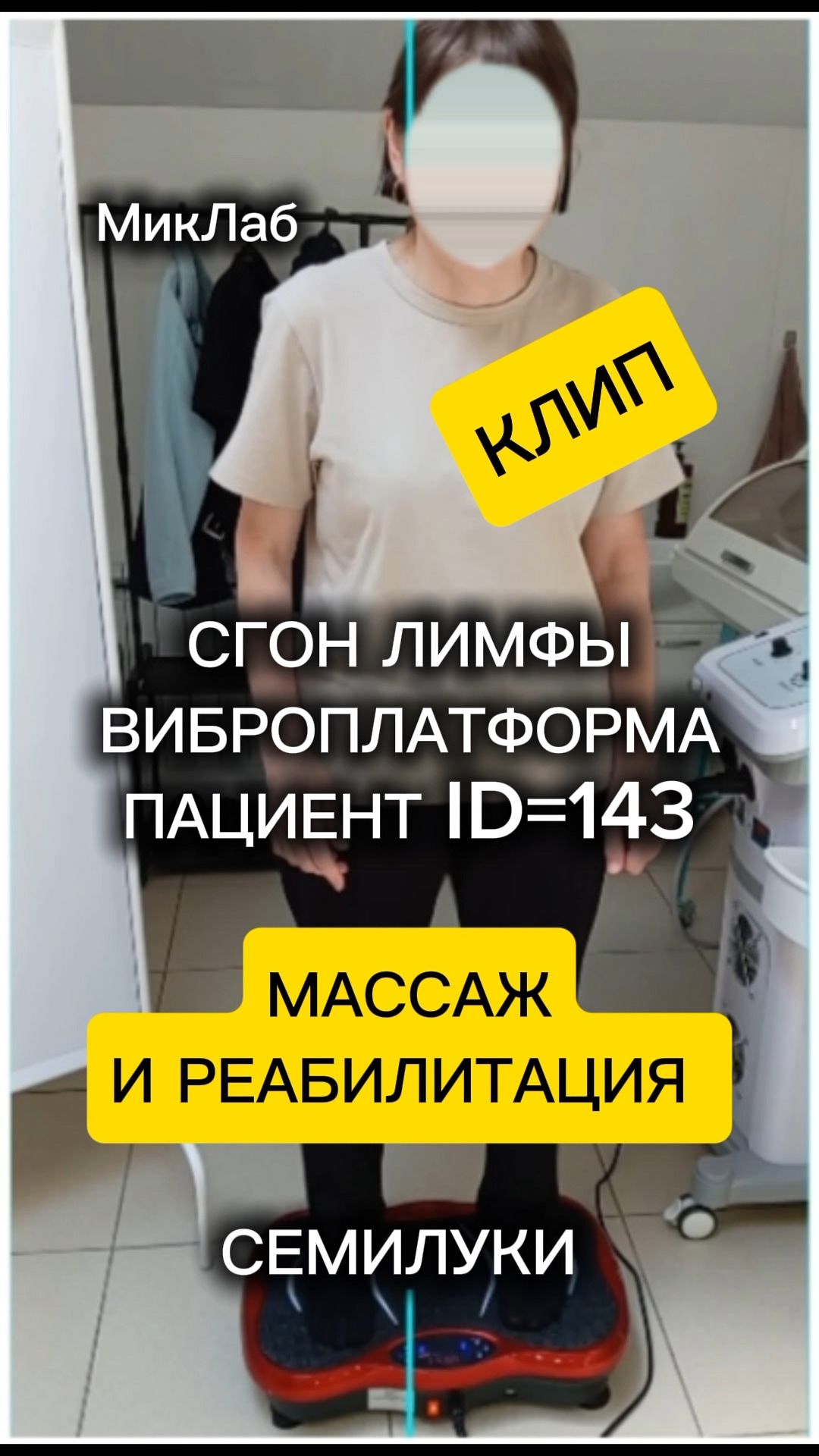 Сгон ЛИМФЫ. ВиброПлатформа. Клип. Пациент ID=143. Массаж и Реабилитация Семилуки.  МикЛаб