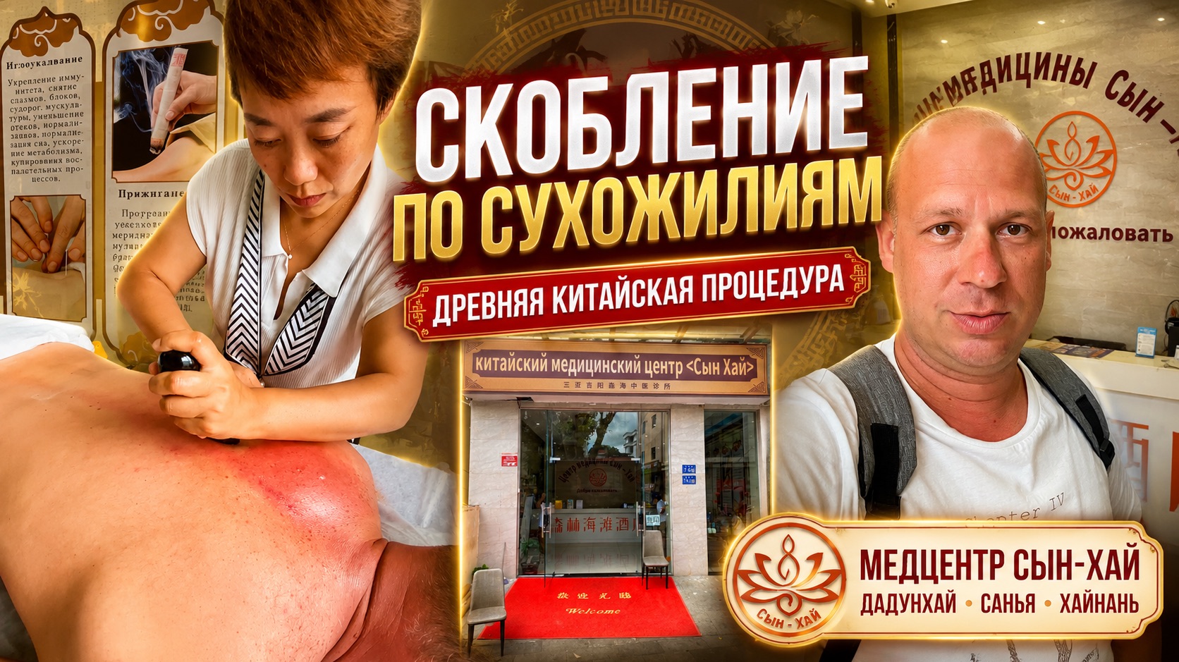 Лечение на Хайнань в Санья в медицинском центре Сын-Хай. Сильная процедура китайской медицины.