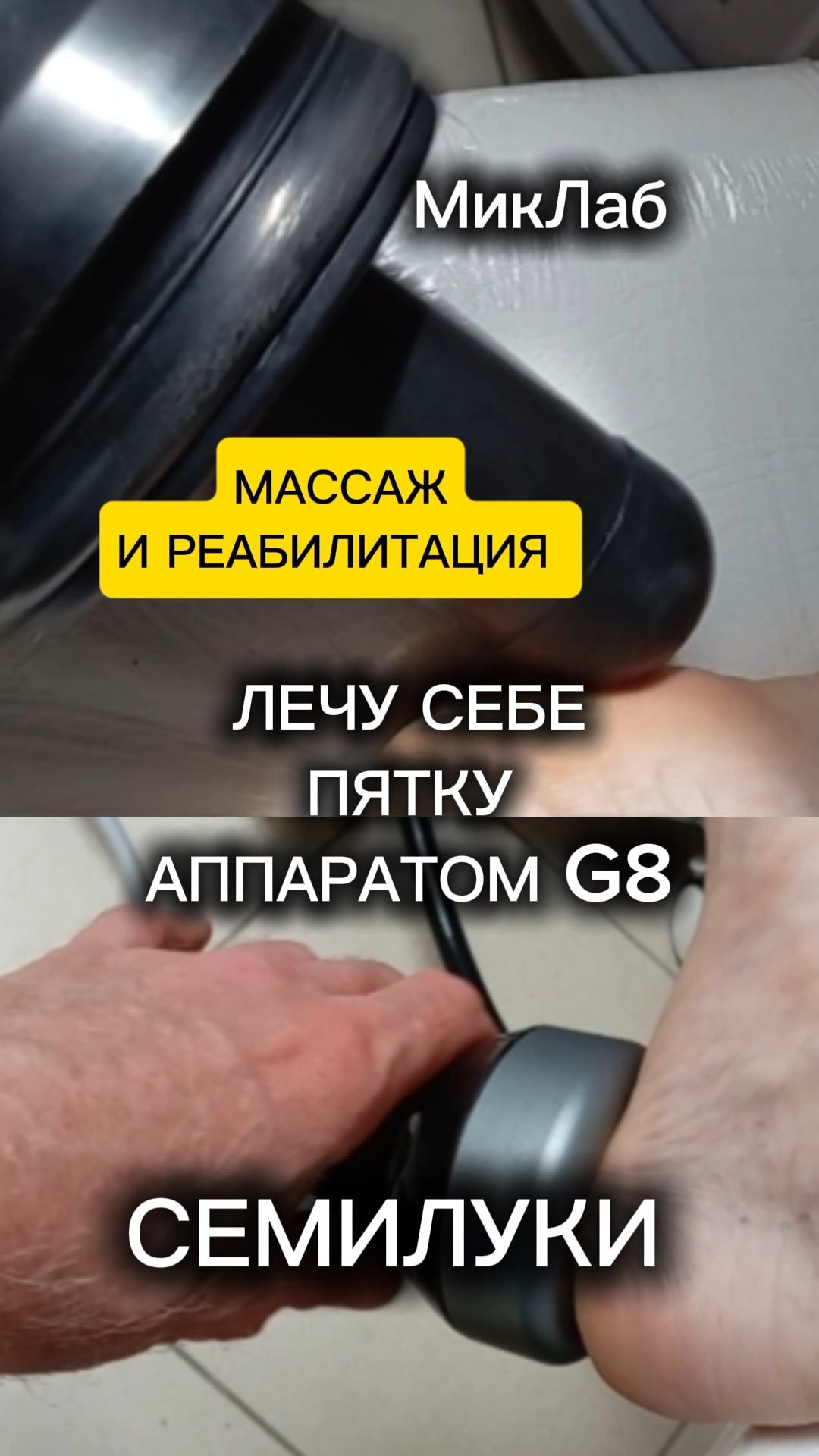 Лечу себе Пятку аппаратом G8. Массаж и Реабилитация Семилуки. Микулин А.Л. 01.06.2026 МикЛаб