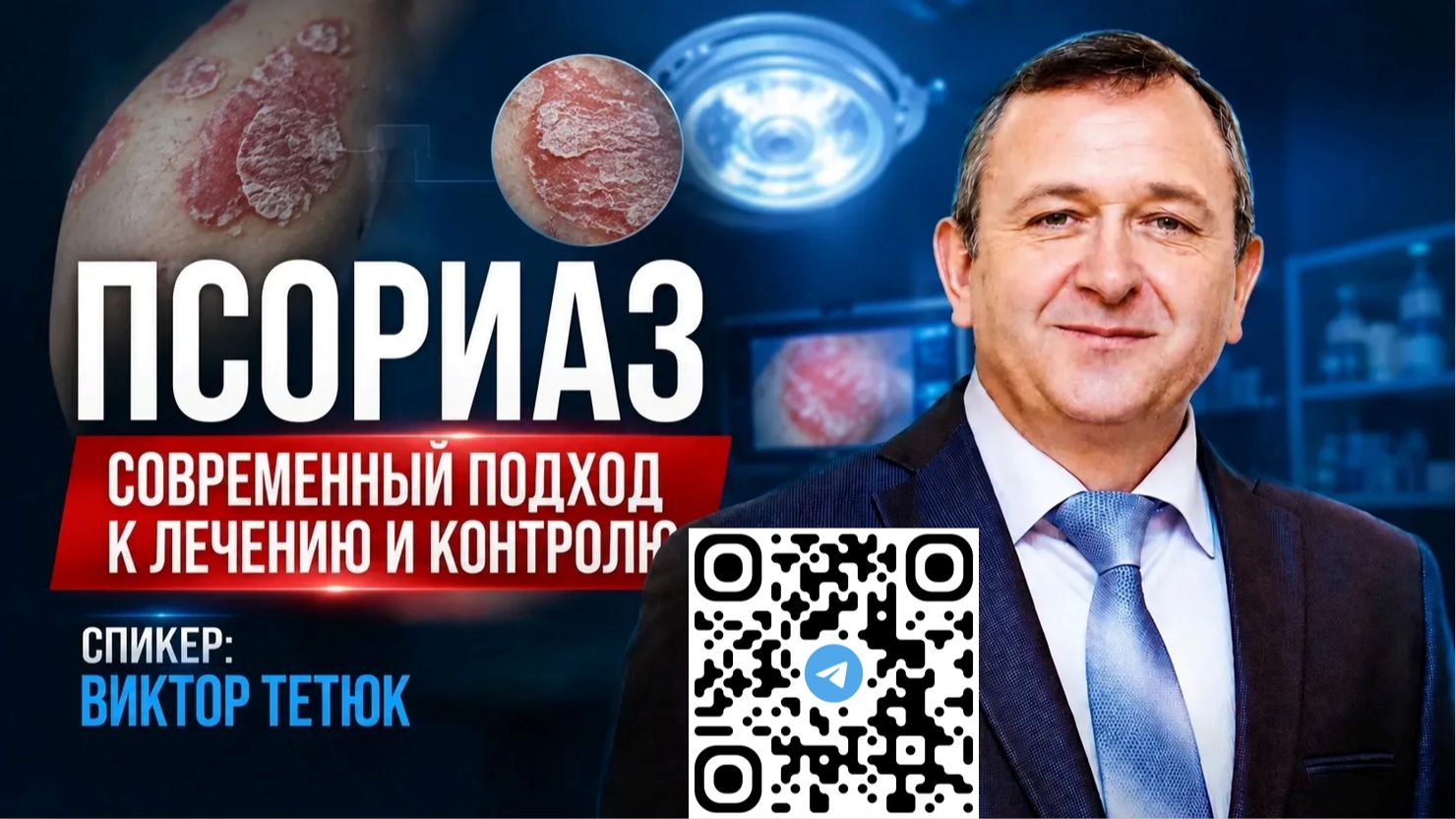 Как вылечить псориаз новые технологии