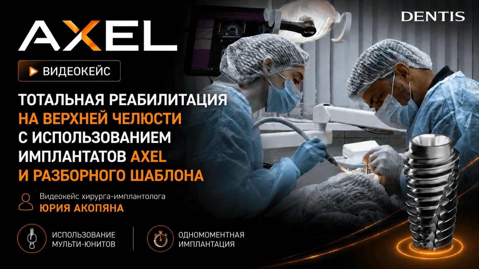 Тотальная реабилитация на верхней челюссти с использованием имплантатов AXEL и разборного шаблона