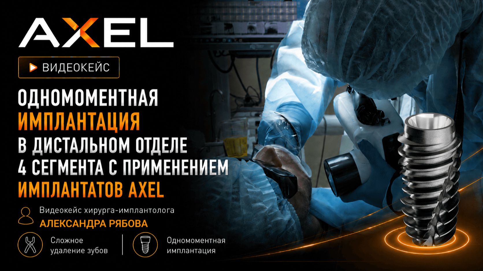 Одномоментная имплантация в дистальном отделе 4го сегмента