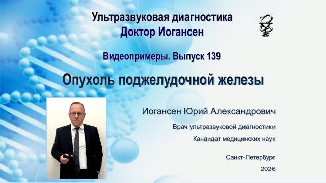 Ультразвуковая диагностика. Доктор Иогансен. Видеопримеры. Выпуск 139. Опухоль поджелудочной железы.