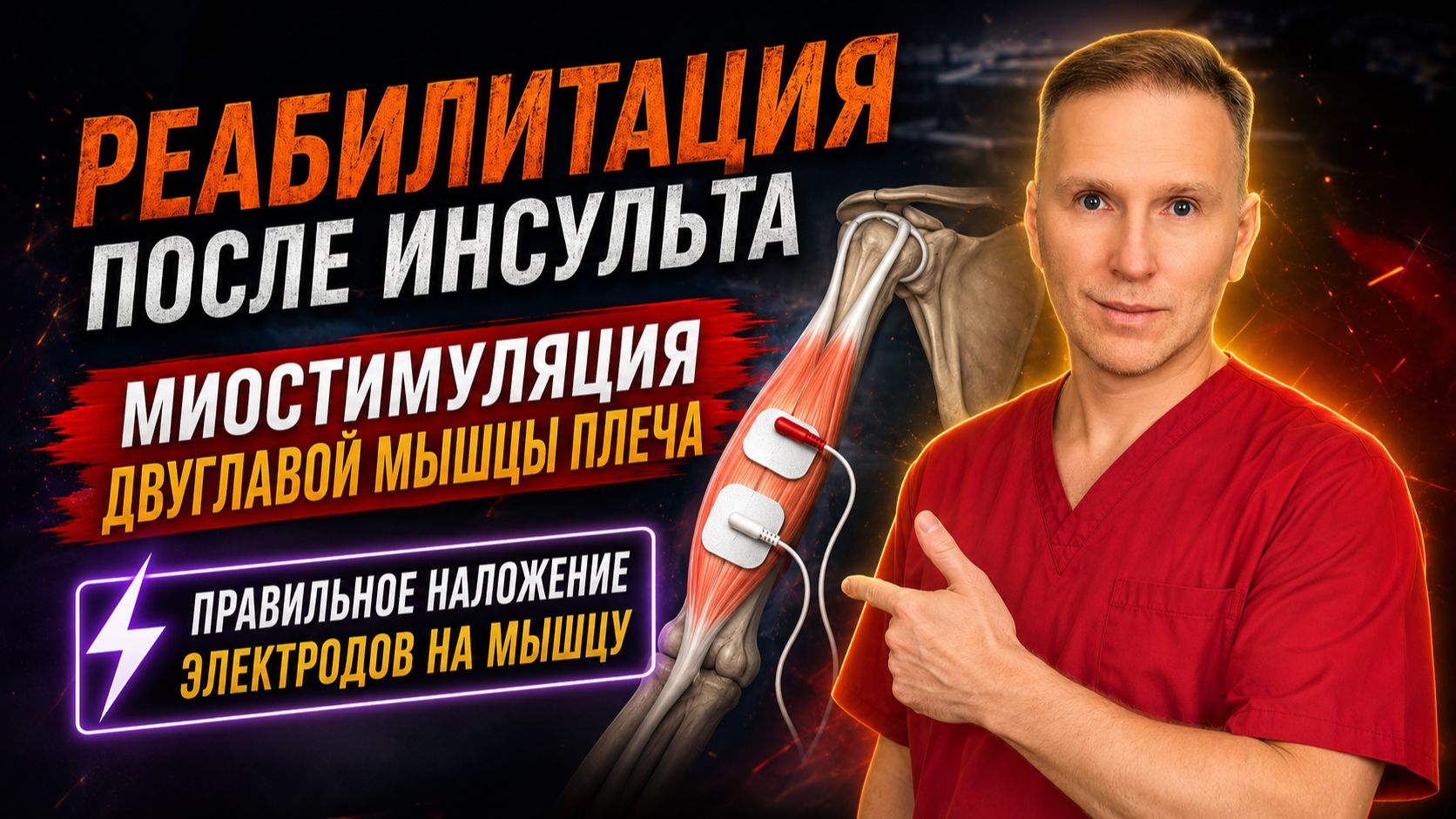Реабилитация после инсульта. Миостимуляция бицепса плеча. Правильное наложение электродов.