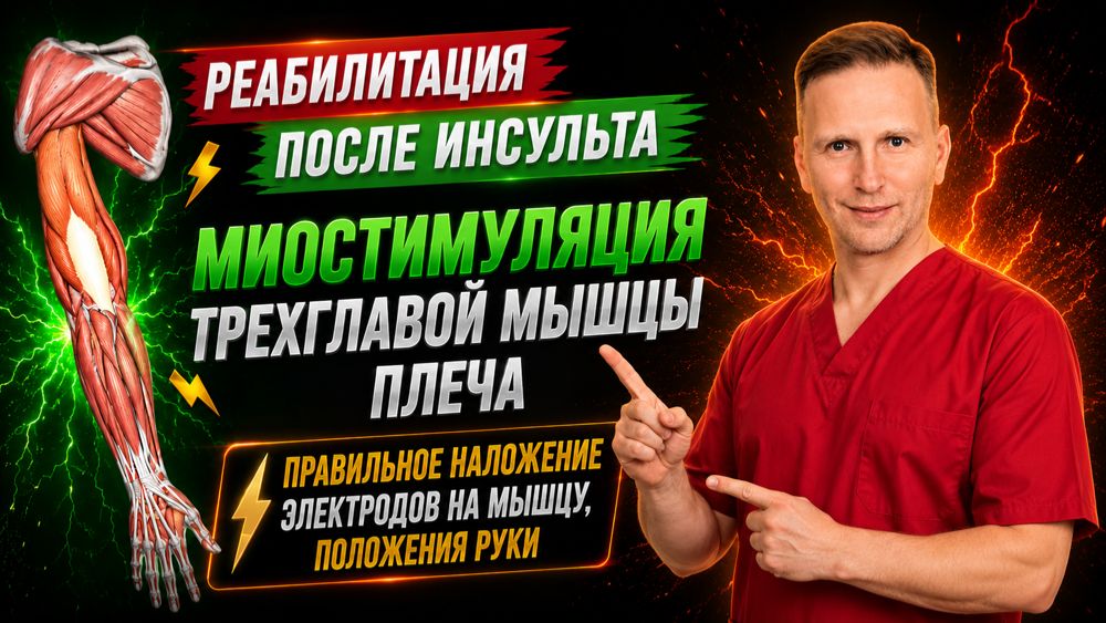 Миостимуляция трехглавой мышцы плеча. Правильное наложение электродов миостимулятора.