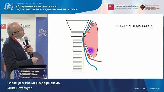 Новые технологии и международный опыт лечения опухолей щитовидной железы, Научная школа 2026 (СПб)