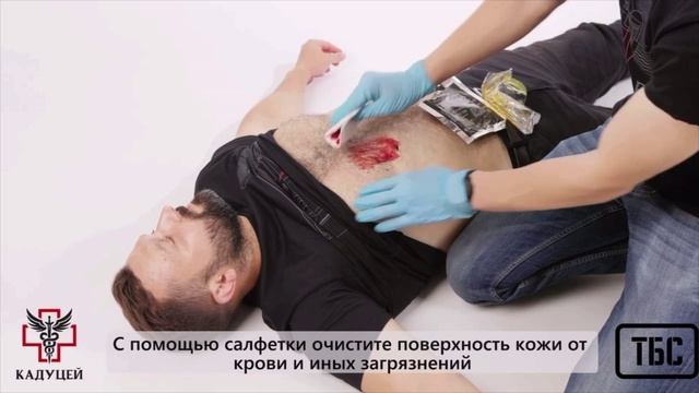 Использование окклюзионной наклейки