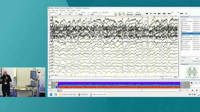 EEG on the ICU- essential insights for non-neurophysiologists ISICEM 45