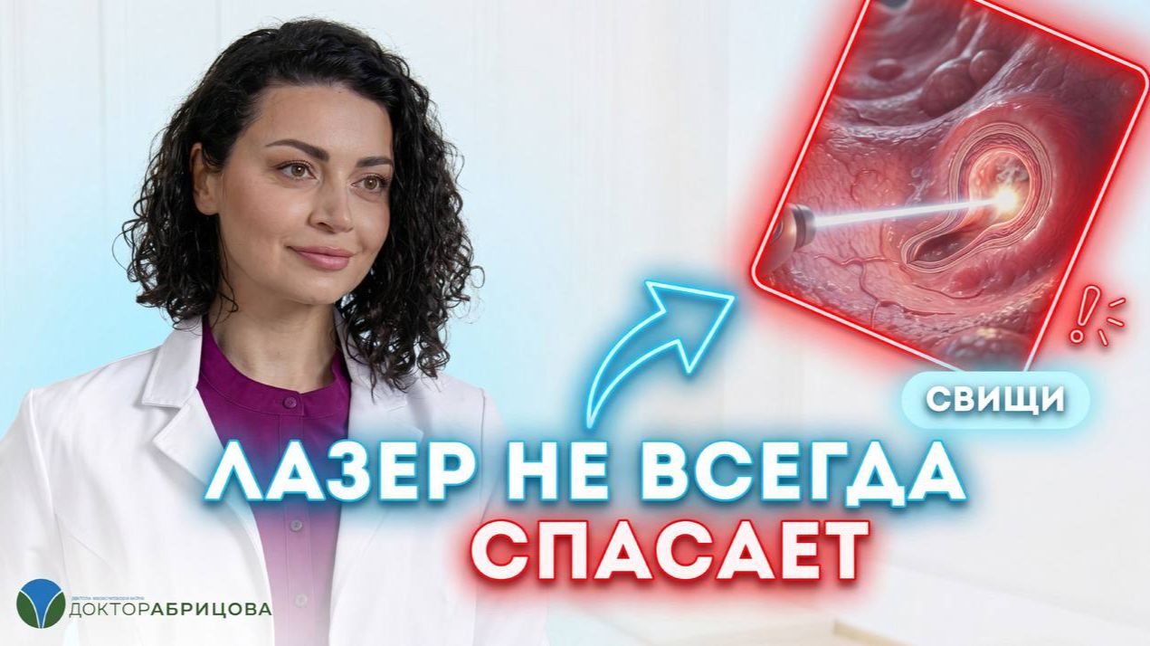 СВИЩ ПРЯМОЙ КИШКИ
