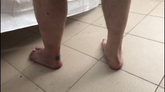 Лечение полного разрыва ахилла, 37 день