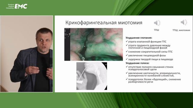2 Решульский С.С. Особенности картины глоточно-пищеводного сегмента у пациентов после ларингэктомии