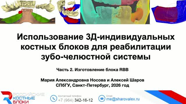 Часть 2. Изготовление блока RBB