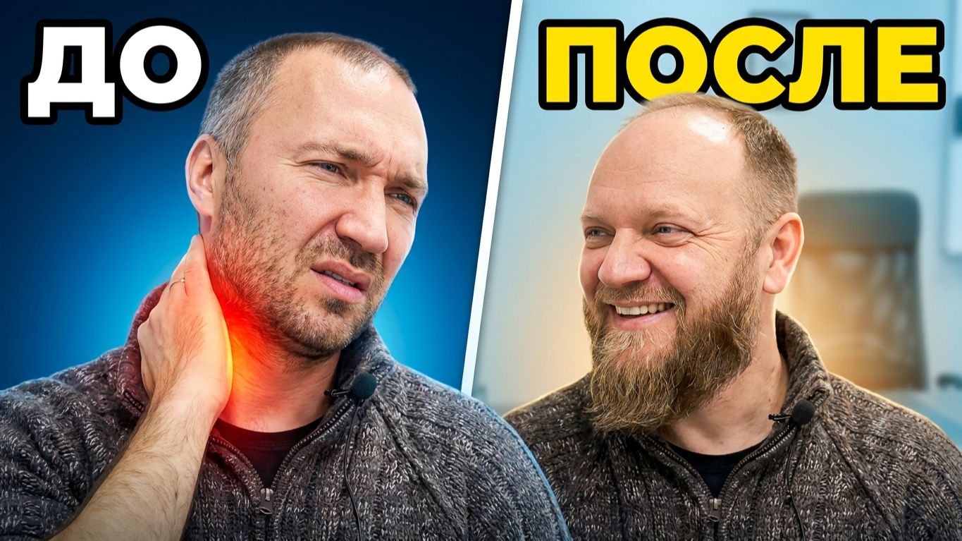 Улучшилась подвижность шеи! ⭐ Коррекция атланта по методу Смолякова ⭐ отзыв через 6 лет ⭐