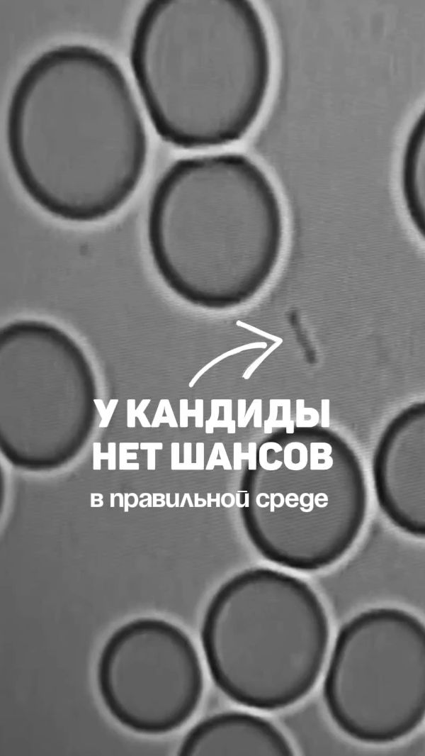 У кандиды нет шансов в слабощелочной среде. Семейный доктор Алена Братишко