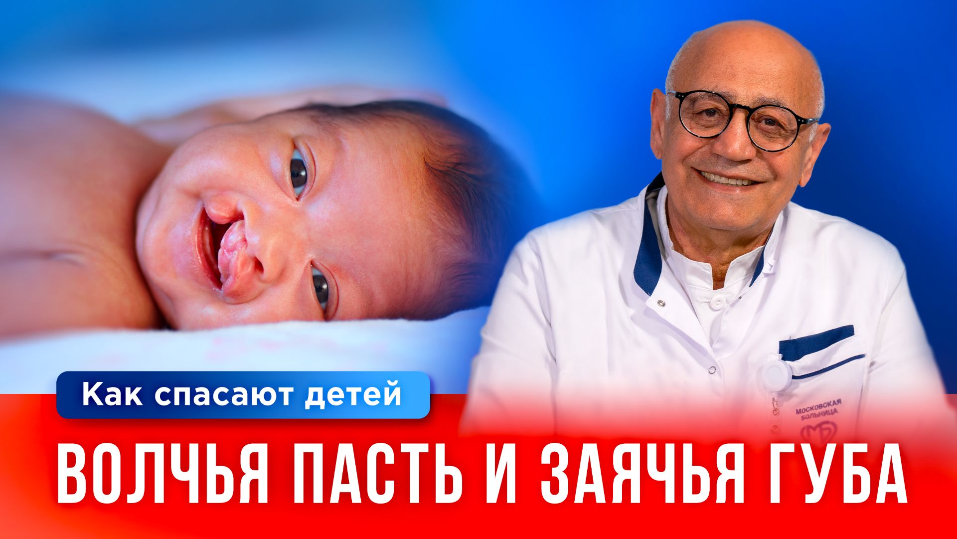 Заячья губа и волчья пасть: почему появляется и как лечат бесплатно по ОМС