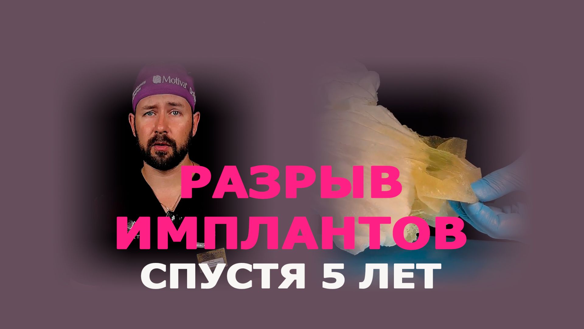 Пластическая хирургия