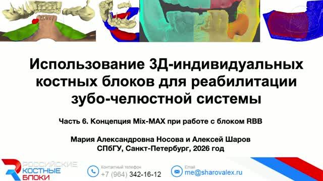 Часть 6. Концепция Mix-MAX при работе с блоком RBB