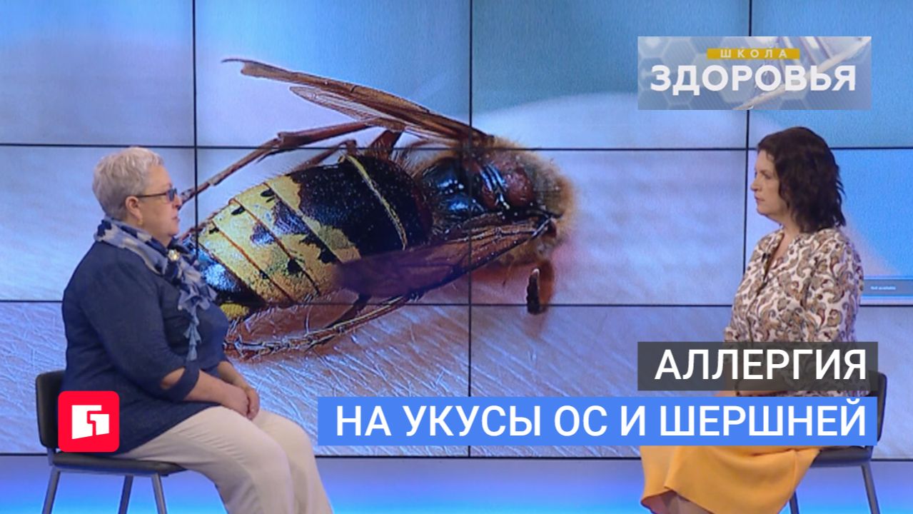 Аллергия на укусы ос и шершней. Школа здоровья. GuberniaTV