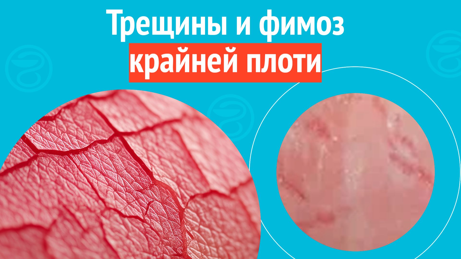 Мужские болезни
