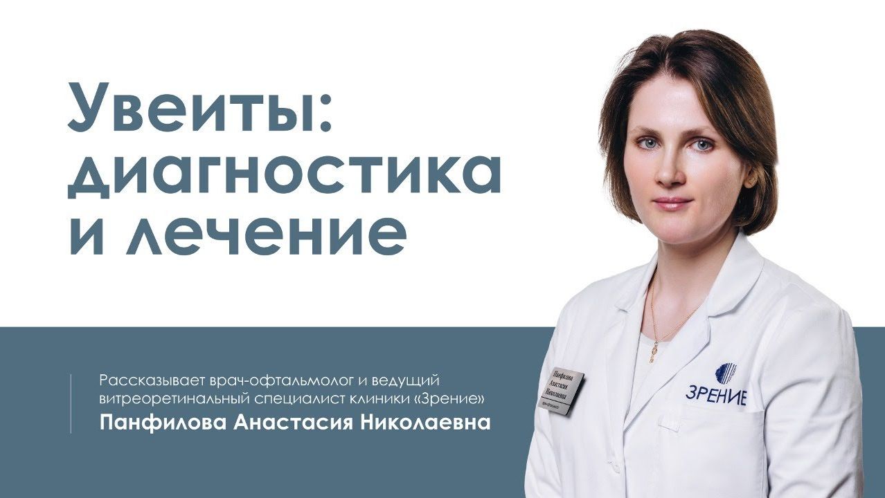 Увеиты