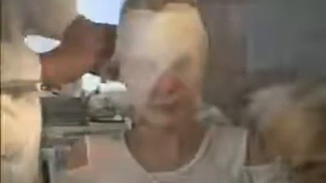 05_Повязка на оба глаза