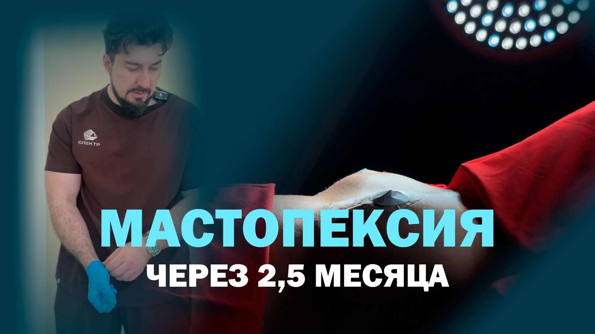 Маммопластика