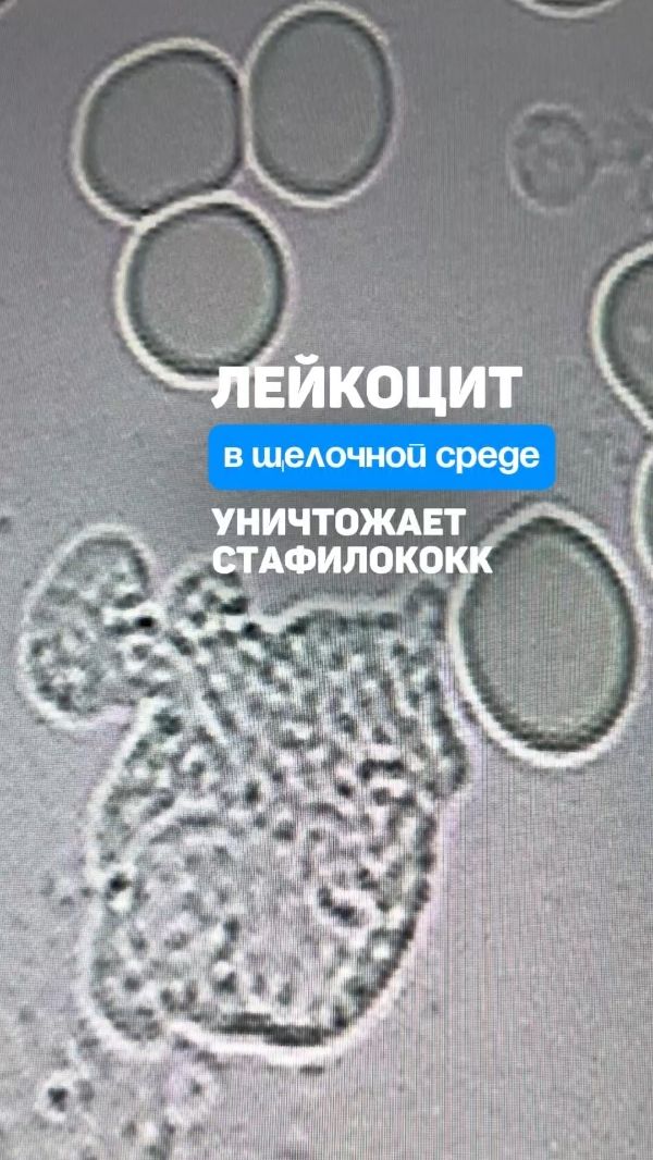 Лейкоцит в щелочной среде уничтожает стафилококк. Съемки под микроскопом. Алена Братишко