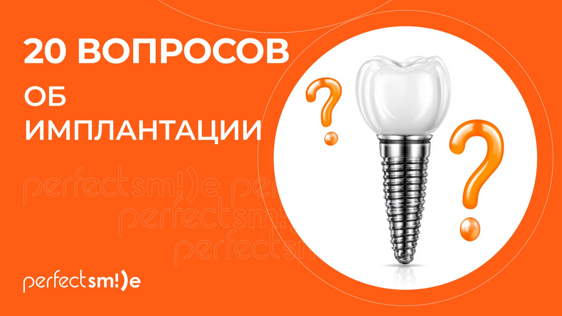 🦷 Имплантация зубов: 20 ЧЕСТНЫХ ответов на ваши вопросы