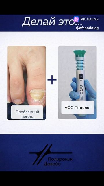 Аппараты