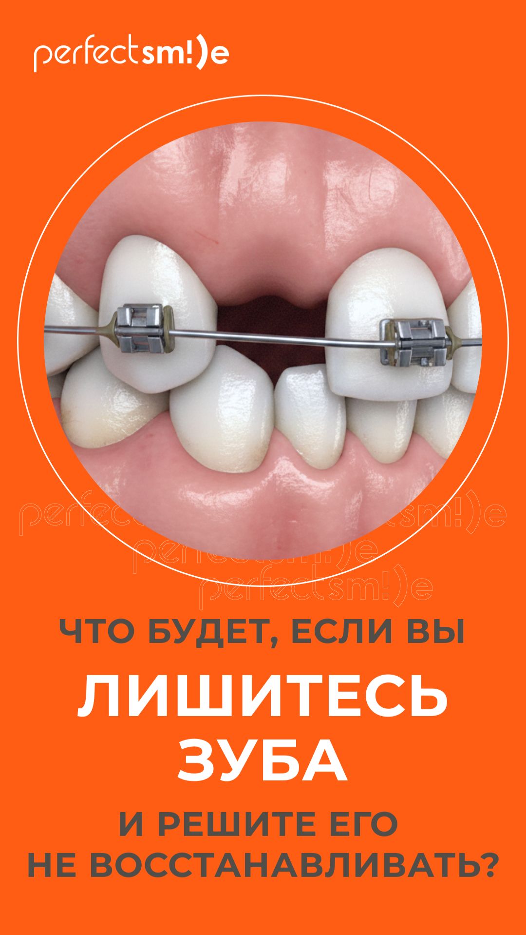 ✅ Один зуб и здоровье всей челюсти