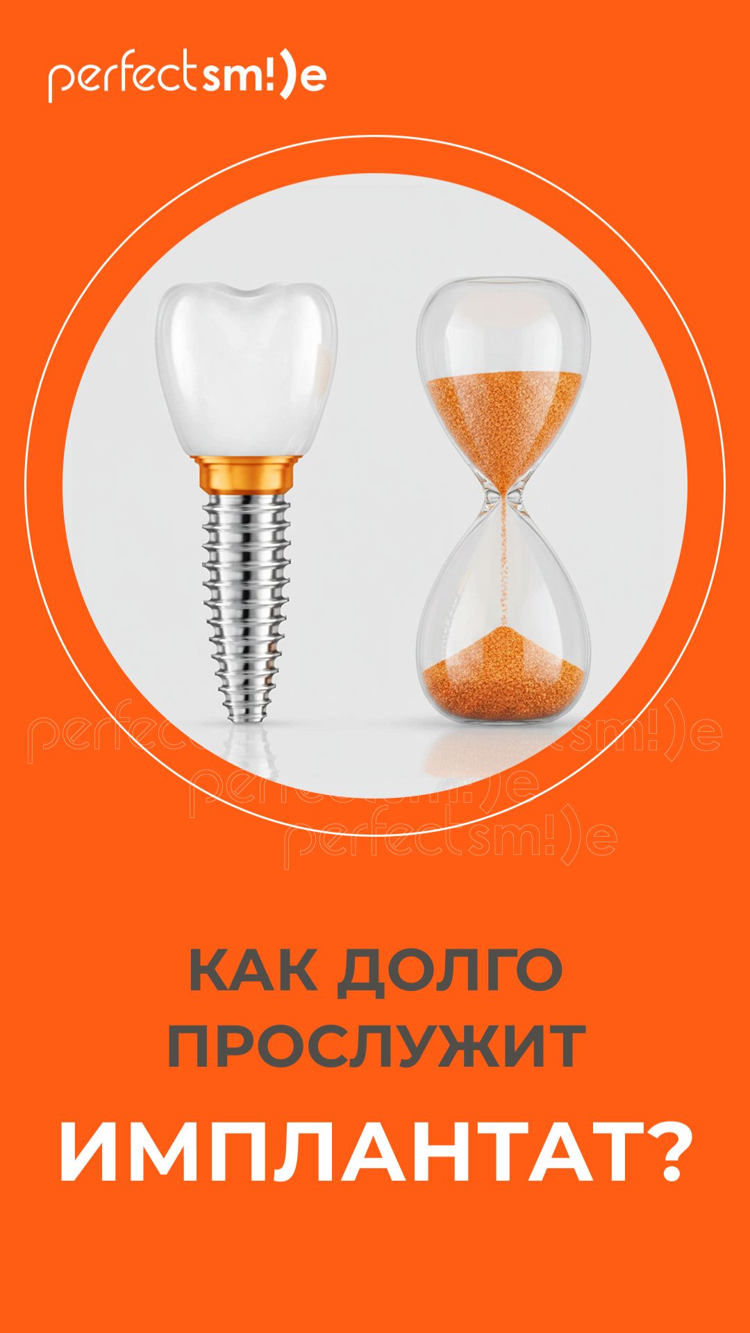🦷 Срок службы импланта: на сколько его хватит?