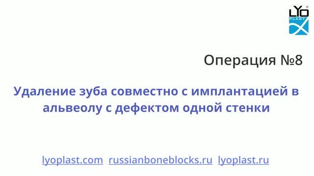 Мультики хирургических операций