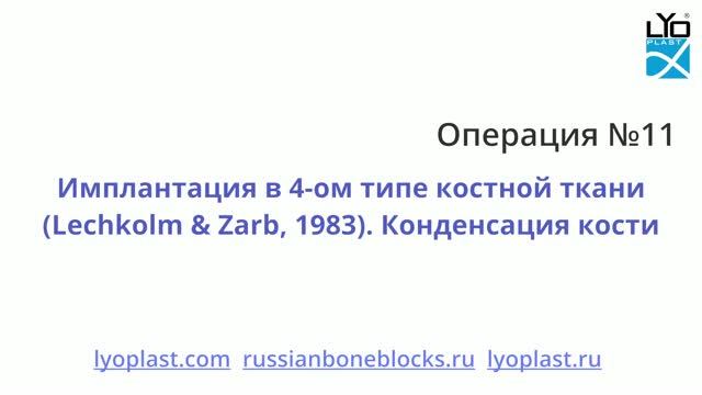 Операция №11 Имплантация в 4-ом типе костной ткани (Lechkom & Zarb, 1983). Конденсация кости