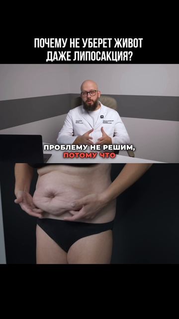 Липомоделирование, липосакция, липофилинг