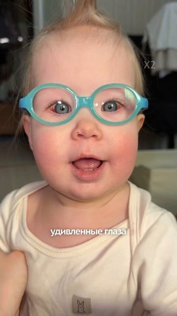Косоглазие
