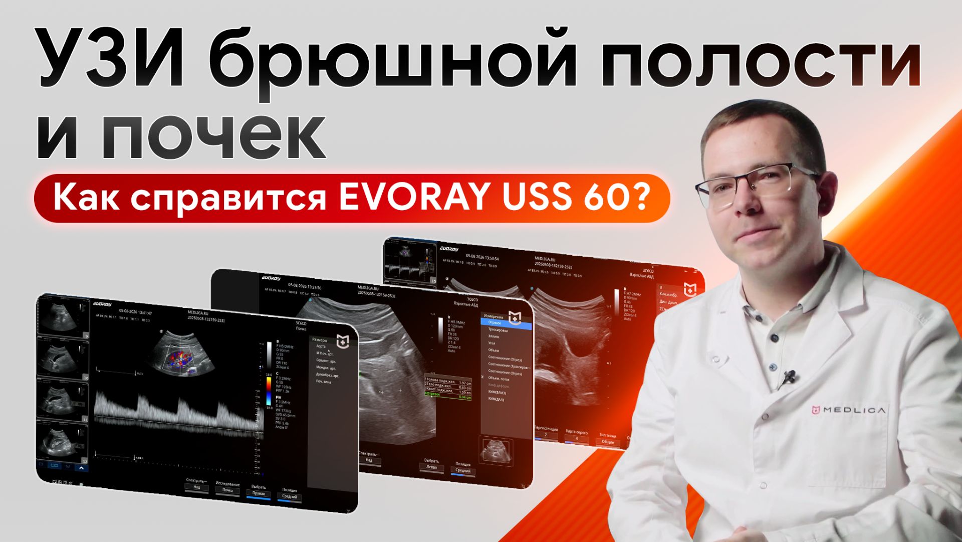 УЗИ органов брюшной полости (ОБП)