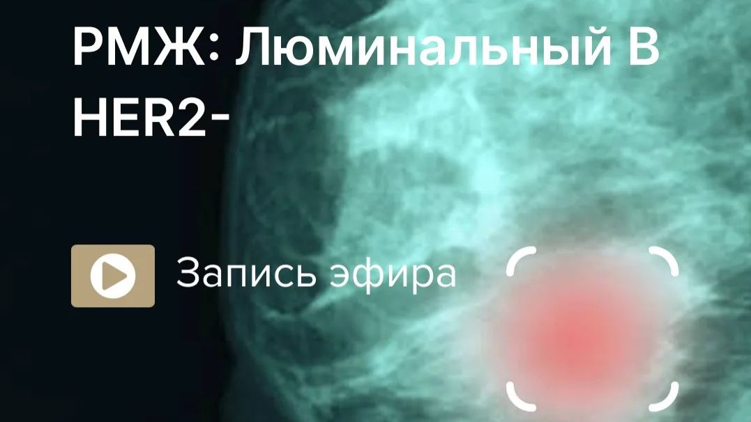 РМЖ: Люминальный В HER2-негатив
